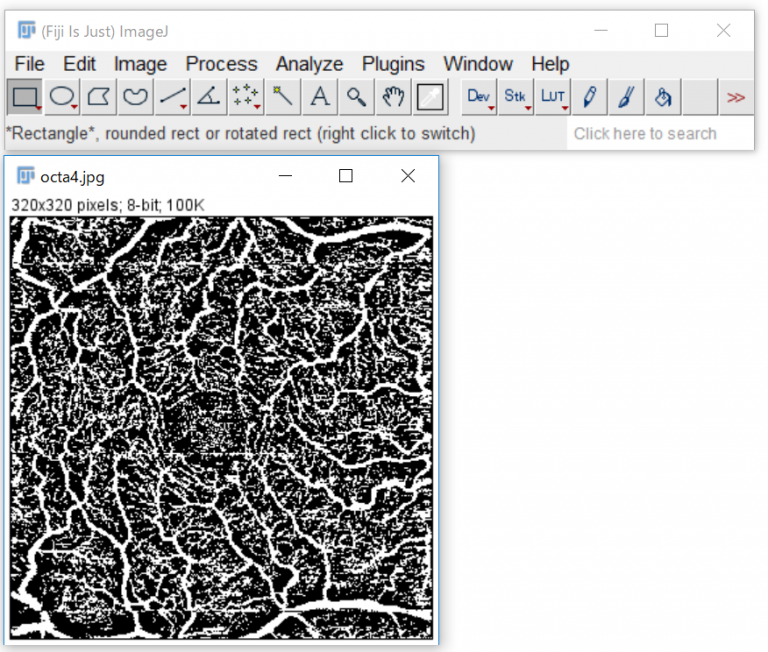 ImageJ(Fiji)でAuto_Threshold-X.Y.Z.jarプラグインを用いて画像を2値化する | WordPressでフリー ...